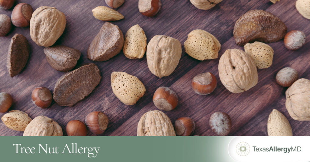 First-Class Tree Nut Allergy Testing and Treatment – TexasAllergyMD