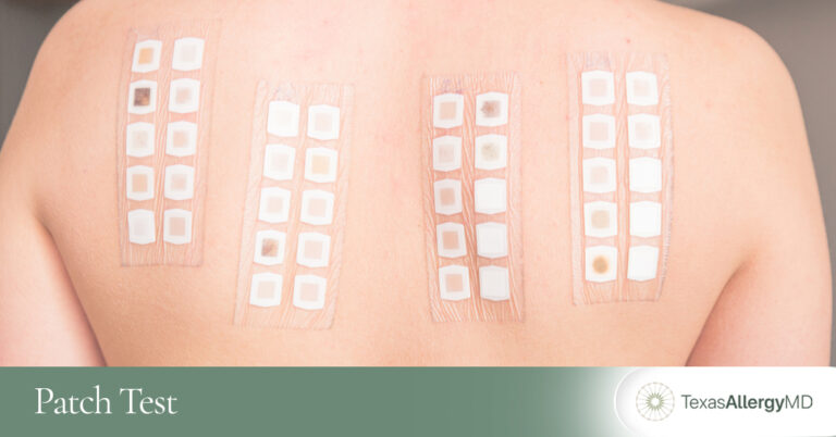 Best Patch Testing Services for Skin Allergies – TexasAllergyMD
